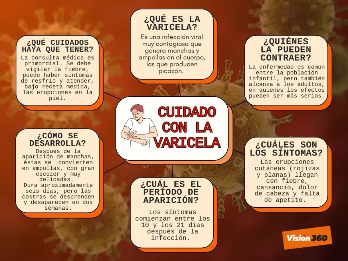 ¿Cómo prevenir la varicela y qué cuidados tener ante un brote? | Visión 360
